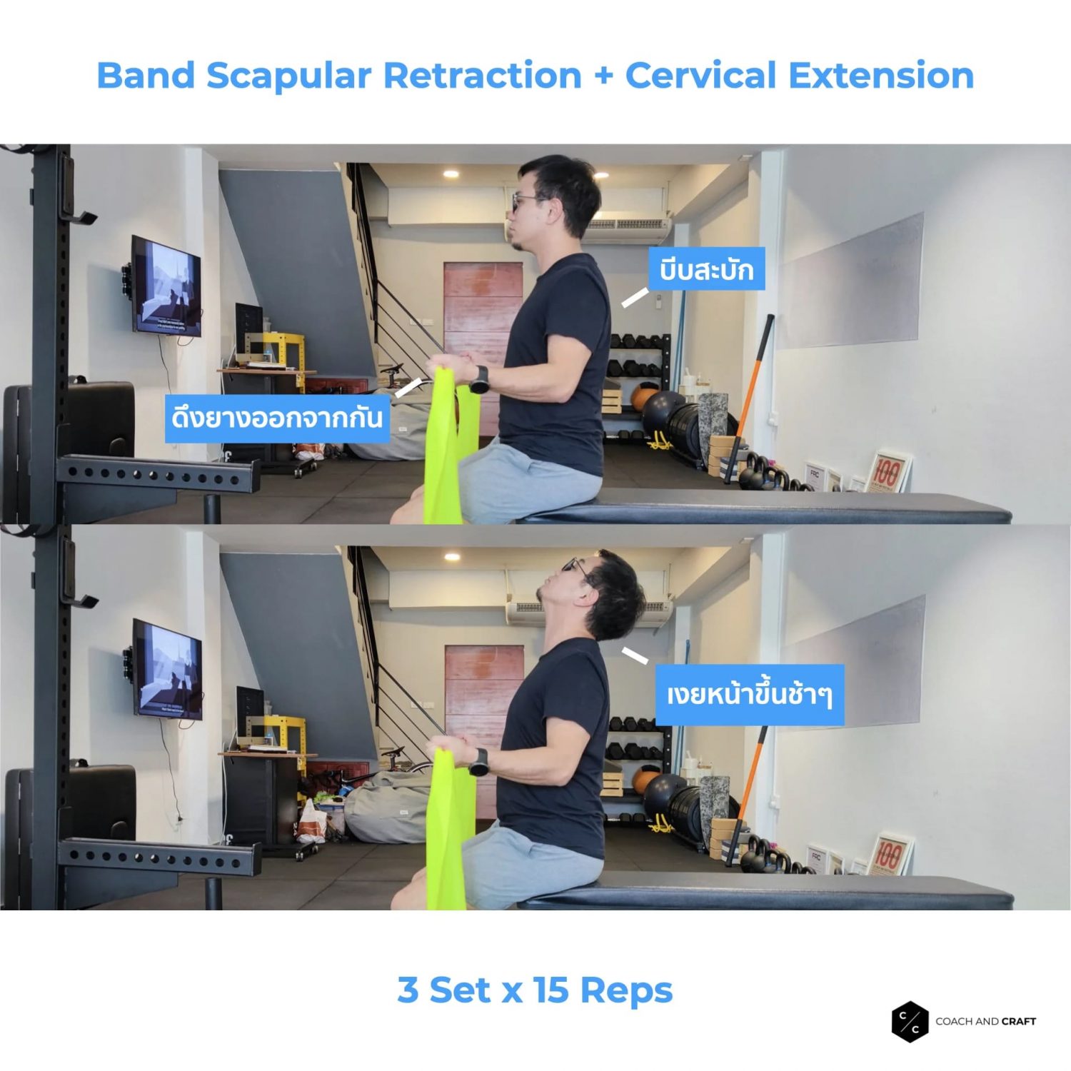 หมอนรองกระดูกทับเส้น ปวดหลัง ปวดคอ ออกกำลังกายยังไงดี?
